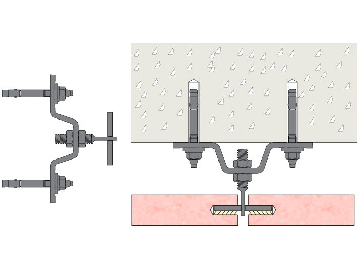 Stainless Steel Cladding Fixing Solutions | Z/L Anchors, Body Anchors ...
